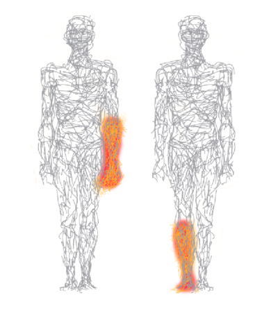 CRPS Clinical Trial - Nona Medical Arts