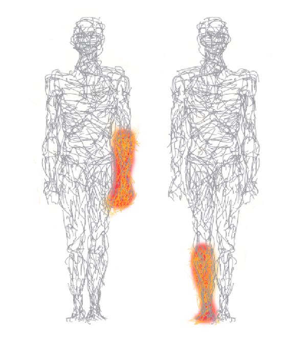 CRPS Clinical Trial - Nona Medical Arts